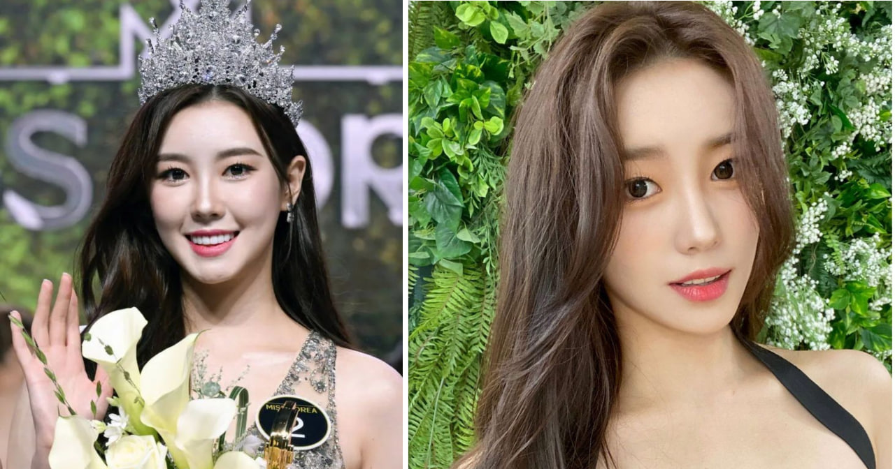 Plastic surgery အရမ်းများပြီး ဆီလီကွန်ရုပ်နဲ့တူနေတာကြောင့် ဝေဖန ...