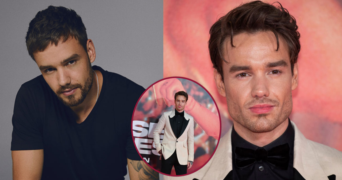 Plastic Surgery လုပ်ခဲ့တယ်လို့ ဝေဖန်ခံနေရတဲ့ One Direction အဖွဲ့ဝင်ဟောင ...