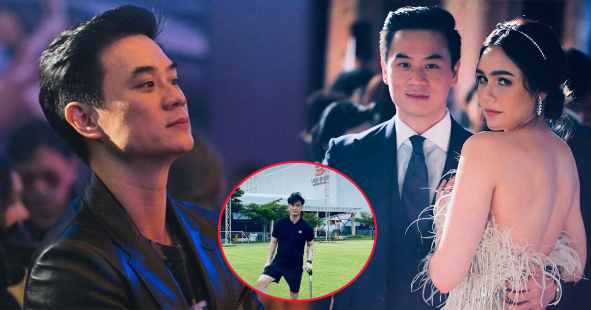 សុខៗស្វាមី Chompoo រងរបួសជើងឈរកាន់ឈើច្រត់ ឲ្យហ្វេនបារម្ភ - Khmerload